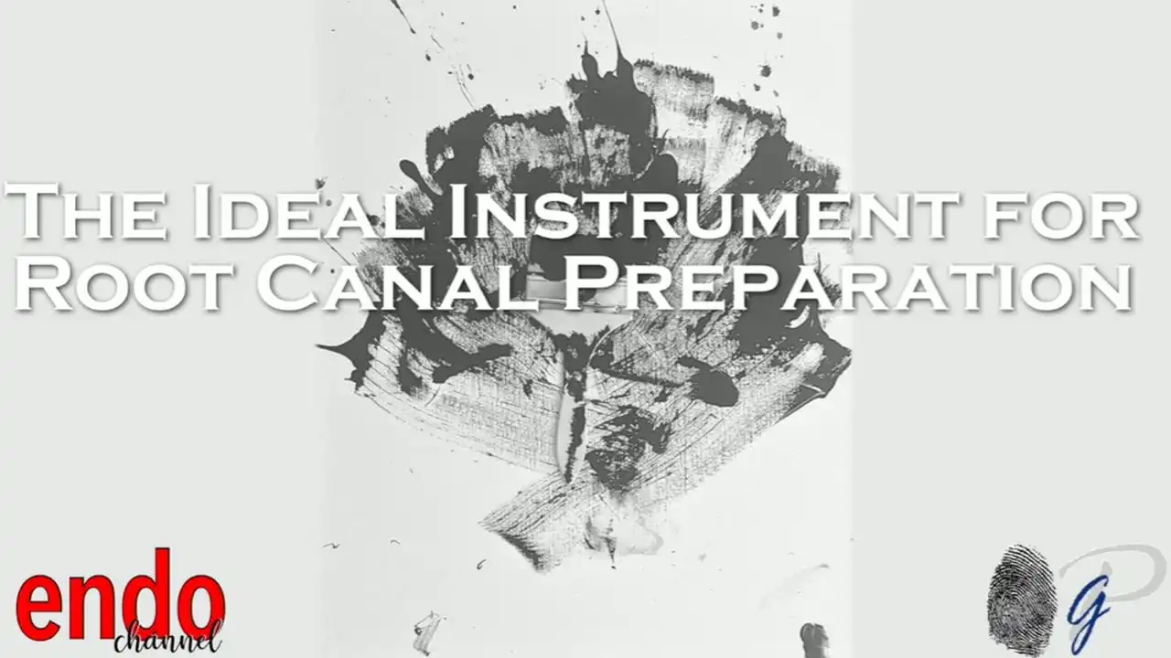 The ideal instrument for root canal shaping