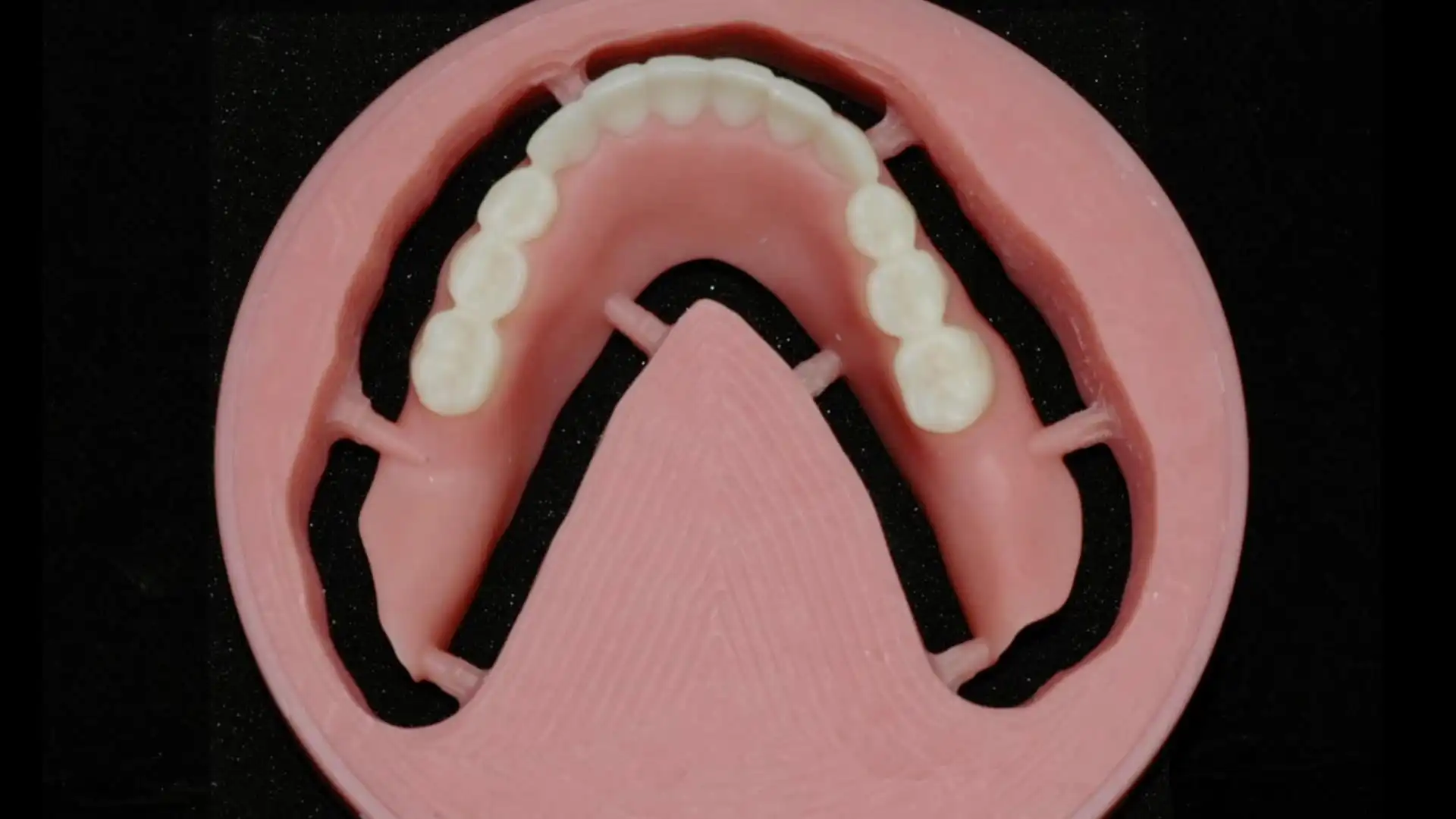 Pro-shell manufacturing: digital technique