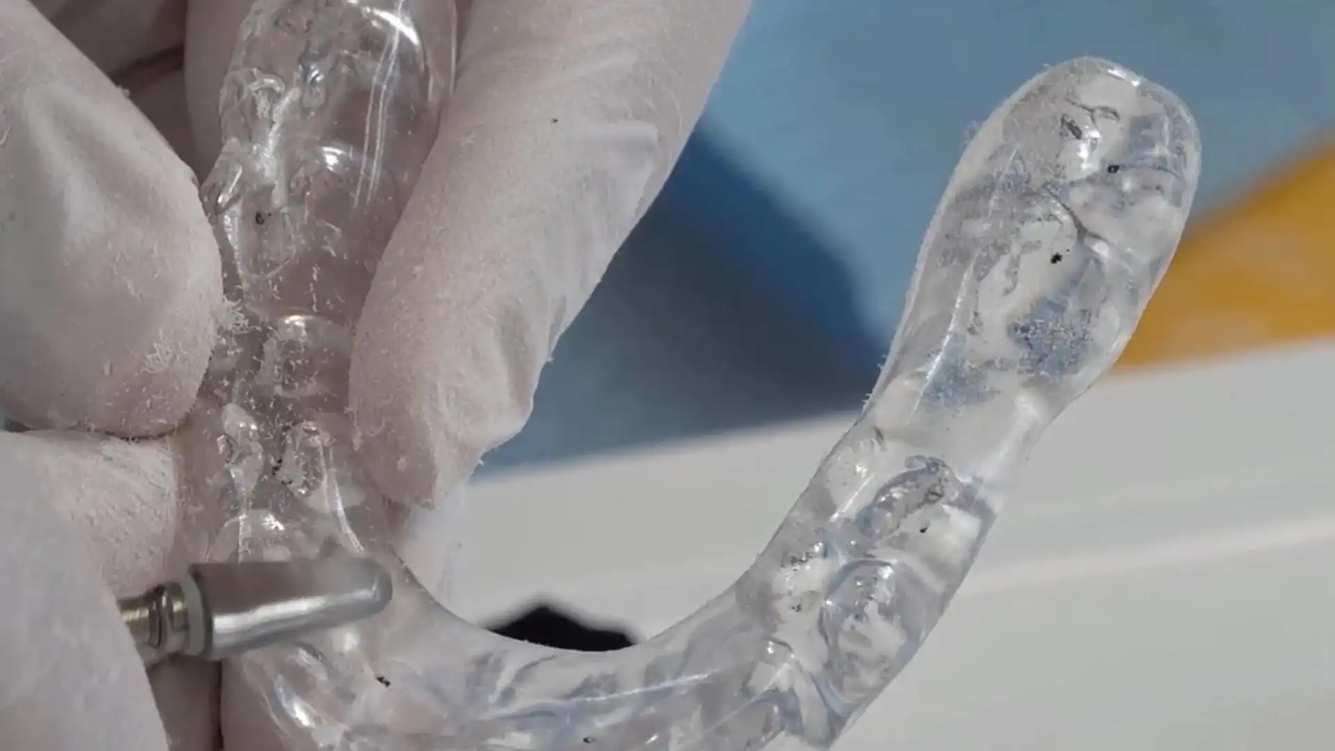 Different steps involved in making Michigan splint