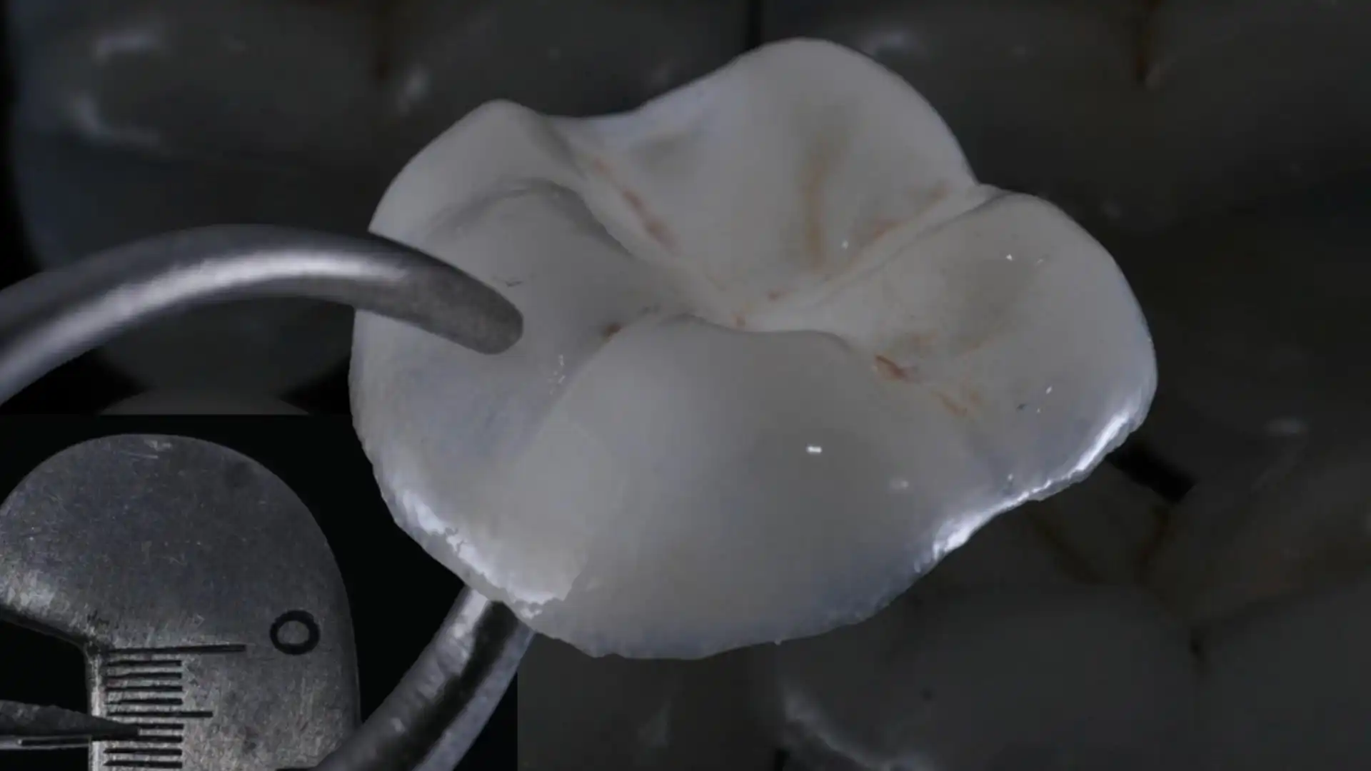 Ceramic materials and color choice for veneer restorations