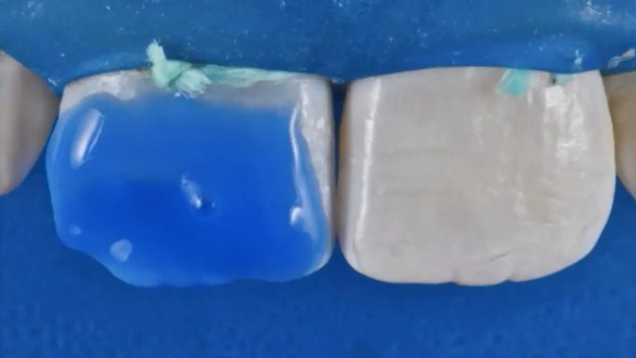 Principles of Adhesion in Enamel