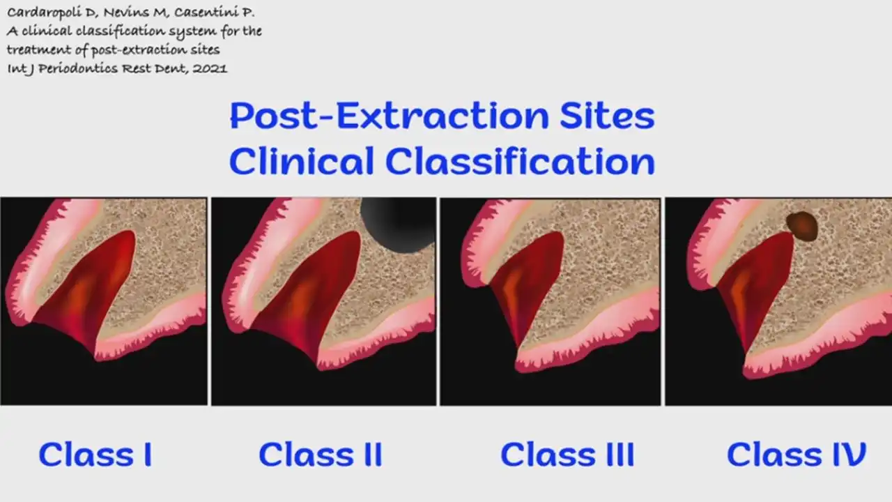 Alveolar ridge augmentation procedures concomitant with dental extraction