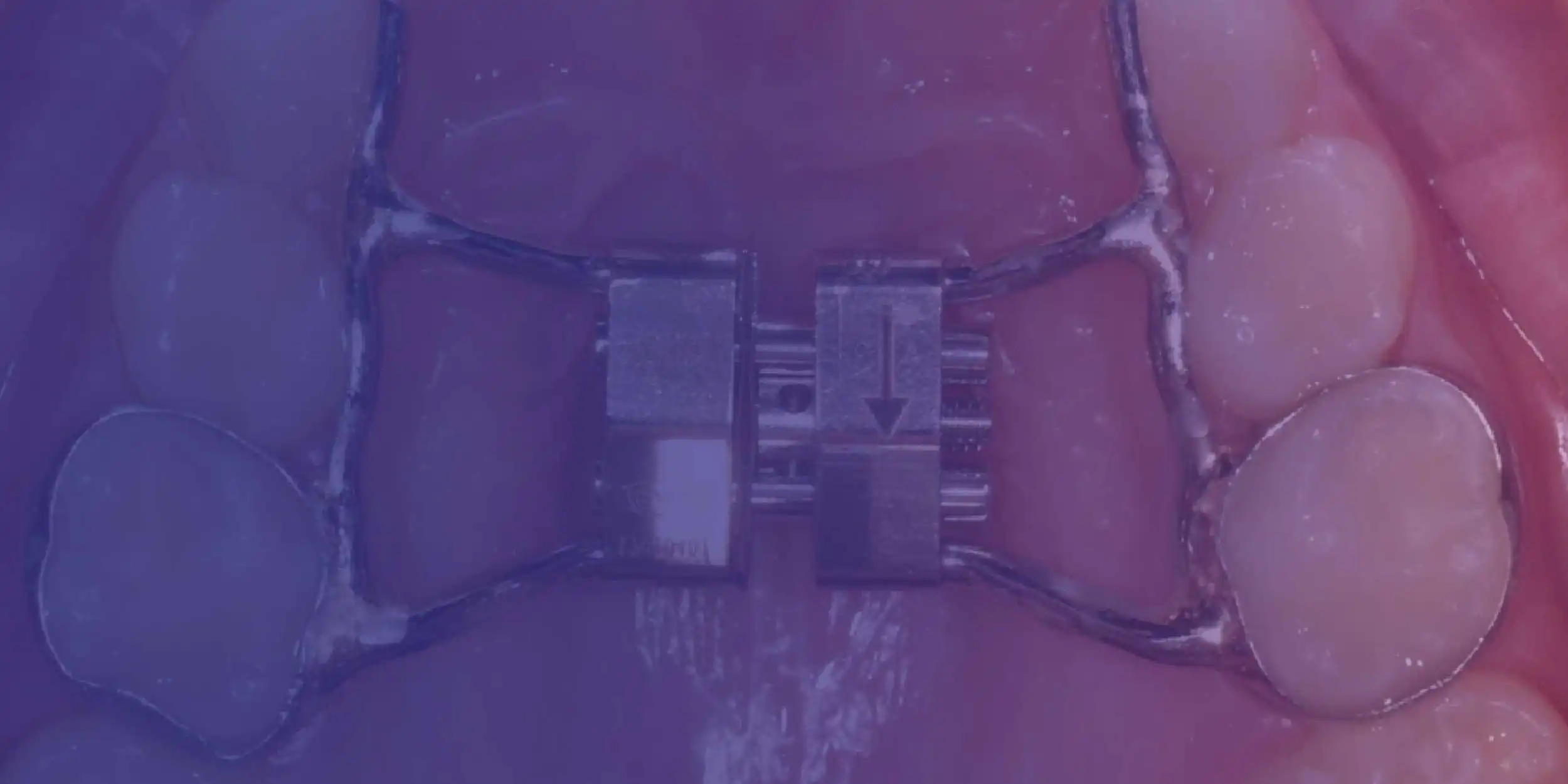 醴 Orthodontics – Dental Video Courses by osteocom