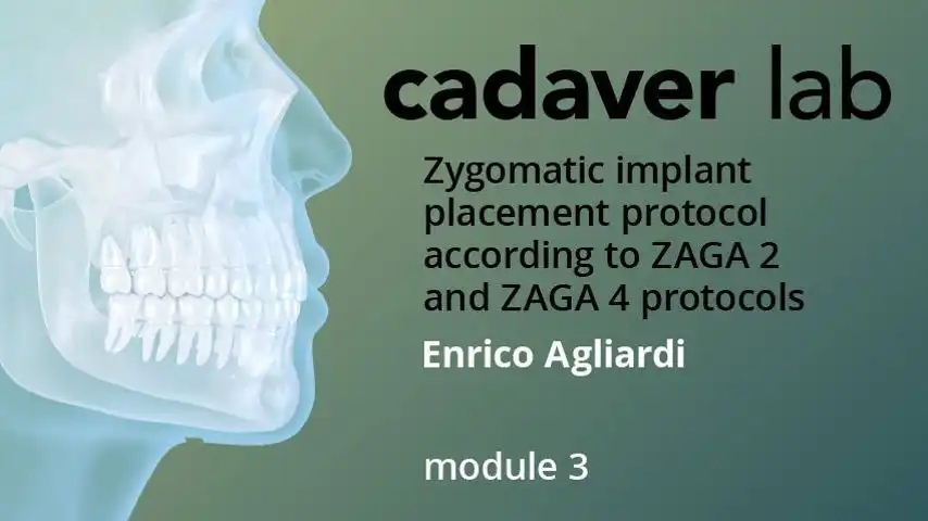 Zygomatic implant placement protocols