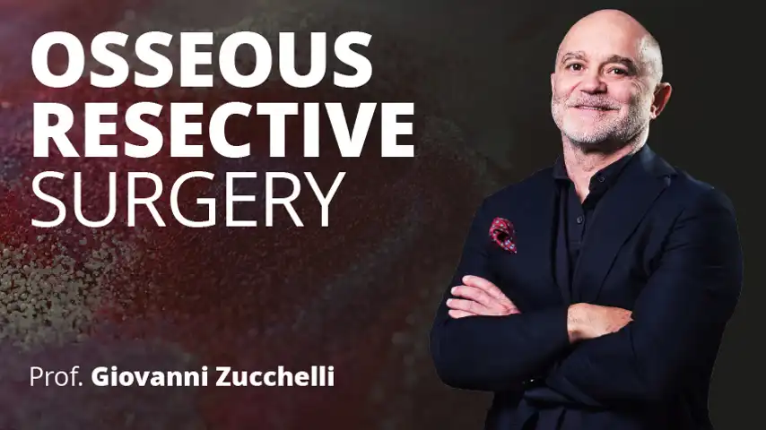 Osseous Resective Surgery