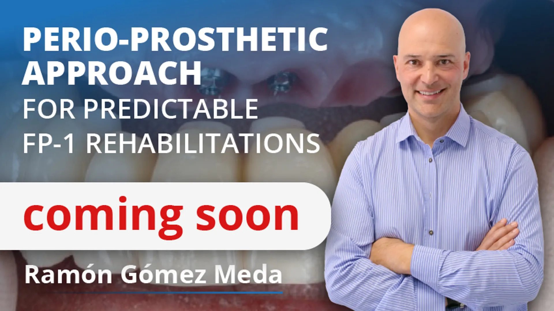 Perio-Prosthetic Approach for FP-1 Rehabilitations - Coming Soon