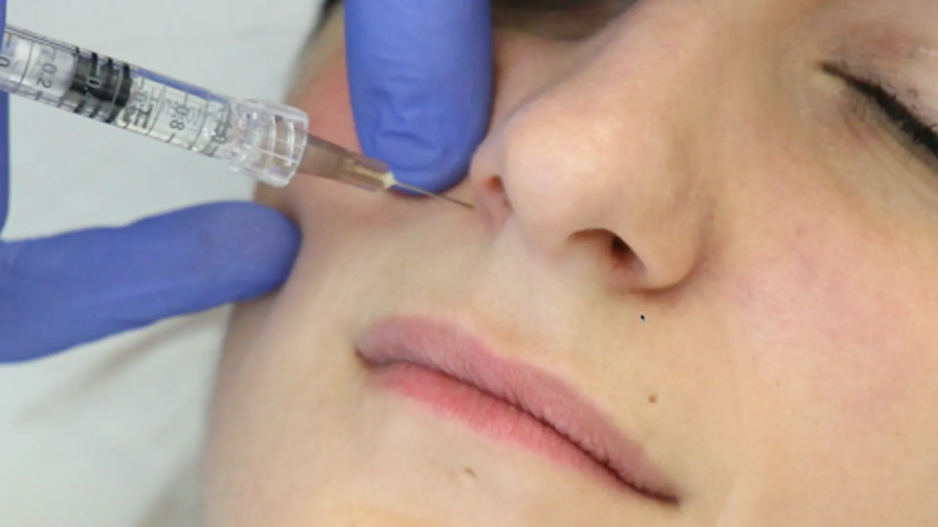 The piriformis area and the lateral cheek