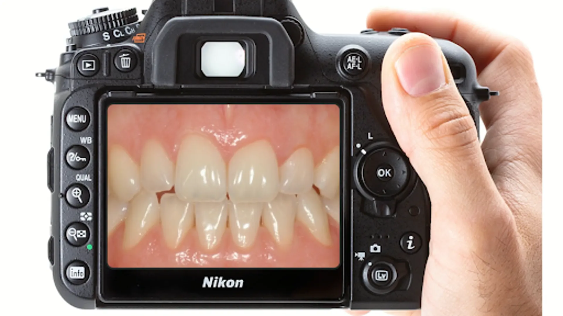 Why dental photography?