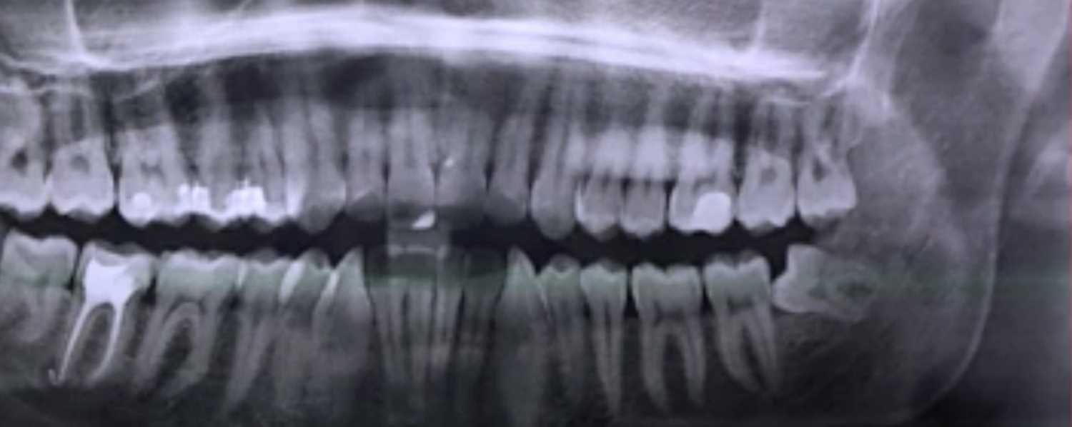 醴 Oral Surgery – Dental Video Courses by osteocom